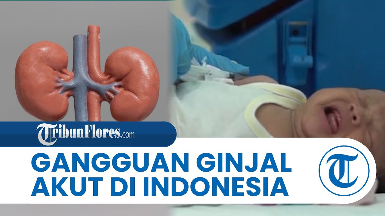 241 Kasus Gangguan Ginjal Akut Tersebar di 22 Provinsi, Jakarta Paling ...