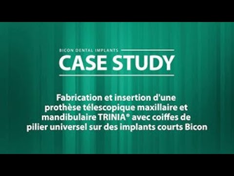 Fabrication et insertion d'une prothèse télescopique maxillaire et mandibulaire TRINIA®