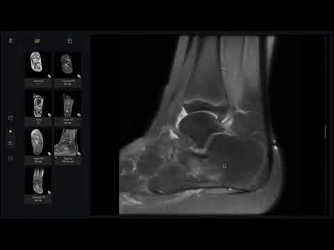 Mixed Viva cases 9 (Part 1)