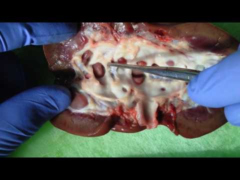 Renal System 1, Kidneys