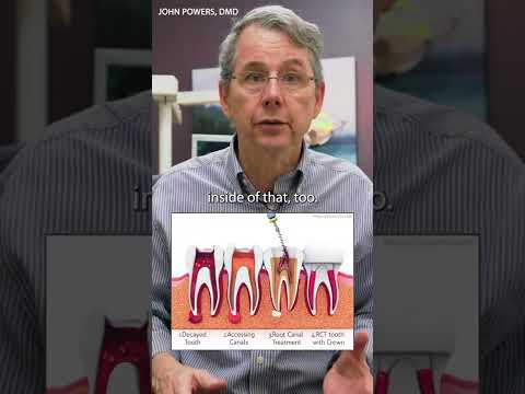 What happens after a root canal? #shorts
