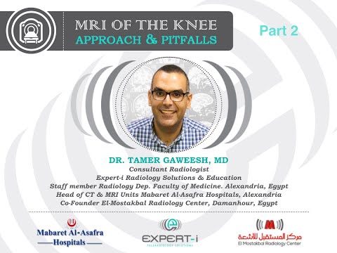 MRI of the knee part 2- Pitfalls, Meniscal tears & Hidden lesions