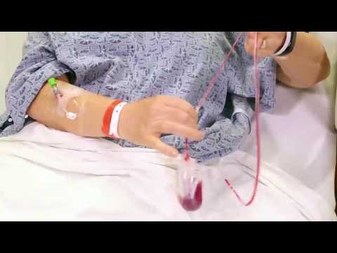 How to Care for Your Surgical Drain (at home)