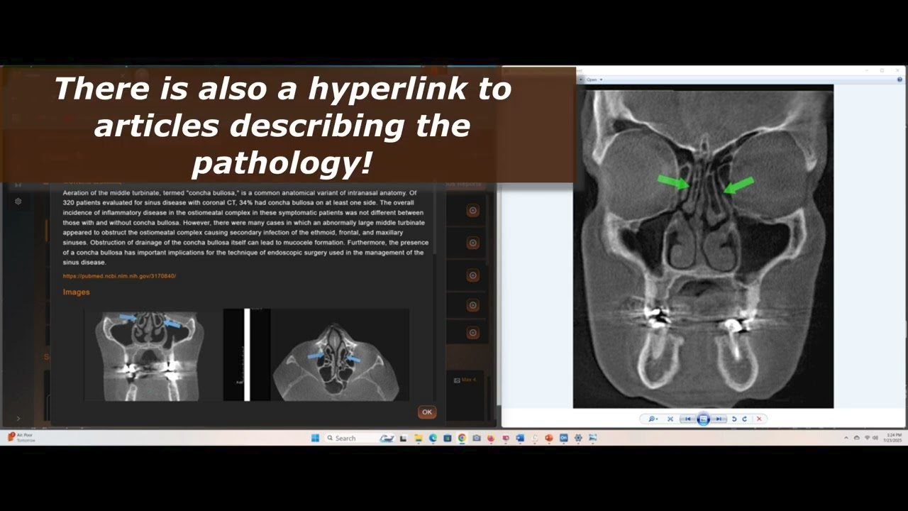 EasyRiter: CBCT reporting software with 