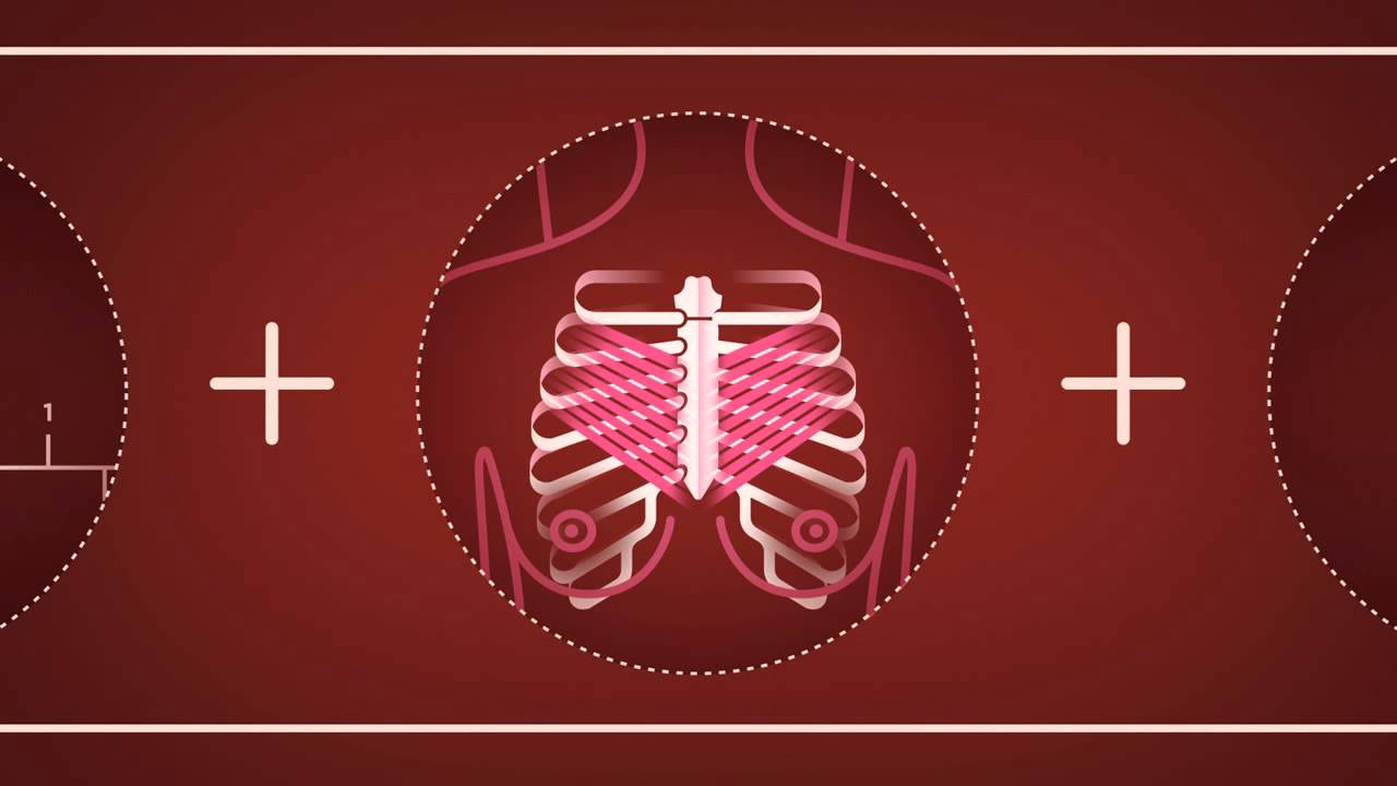 Beyond The Shock - Chapter 5 -  Types & Stages - Stage 3 Breast Cancer