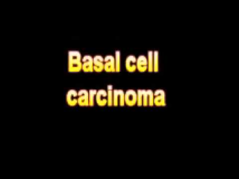 What Is The Definition Of Basal cell carcinoma Medical Dictionary Free Online