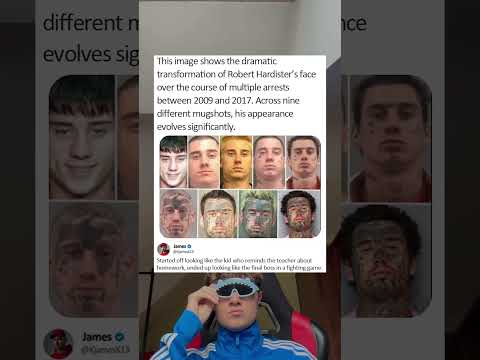 This image shows the dramatic transformation of Robert Hardister's face over the course of multiple