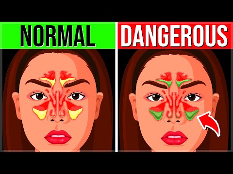 What The Color Of Your MUCUS Is Warning You About Your Health! (Check Your Snot Color)