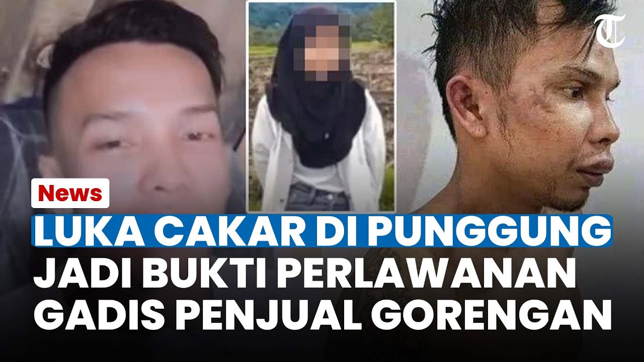 LUKA DI PUNGGUNG Indra Jadi Bukti Perlawanan Nia, Pembunuh Gadis Penjual Gorengan Tak Bisa ...