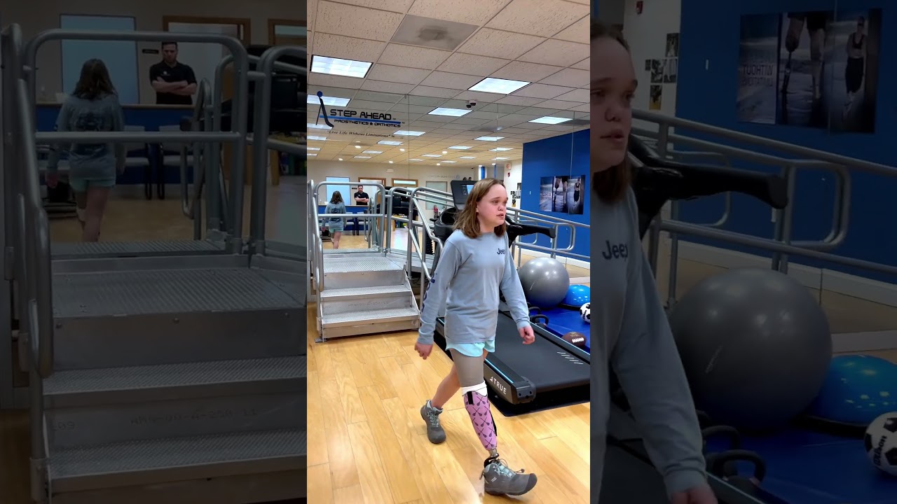 Gracie: Walking with Confidence on Her Below-Knee Prosthetic Leg