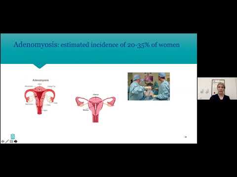 Newton-Wellesley Medical Group Lunch & Learn: Abnormal Uterine Bleeding