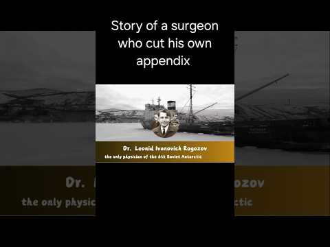 Story of a surgeon who cut his own appendix!!!