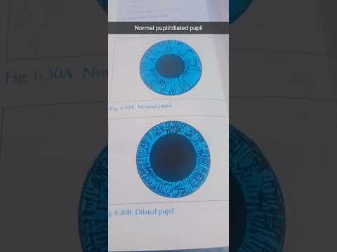 normal pupil/dilated pupil YouTube shorts YouTube shorts YouTube shorts YouTube shorts YouTube