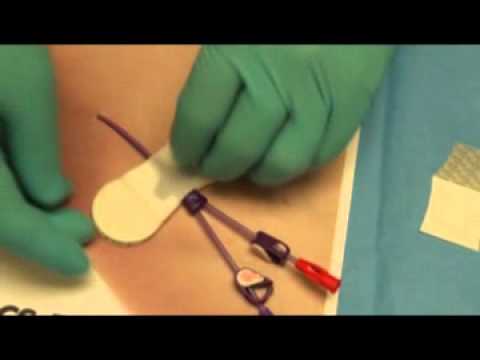 3304MCS BA Video