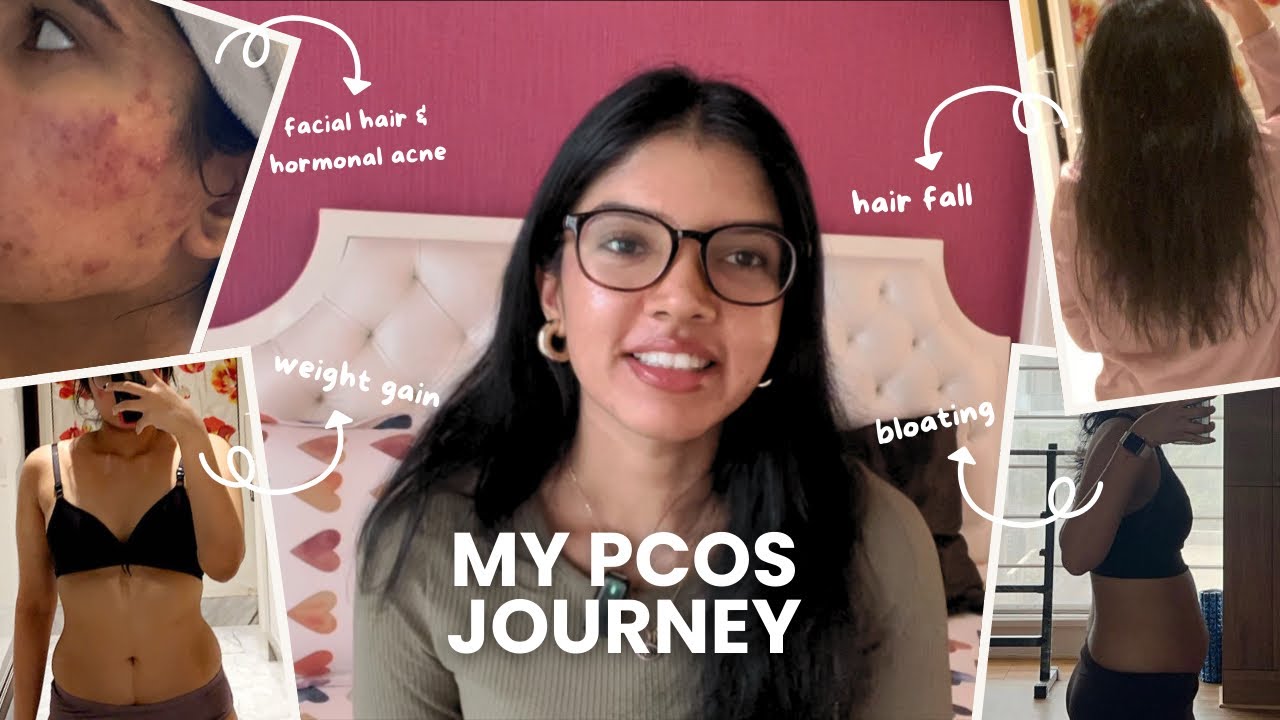 Navigating PCOS: A Personal Journey Towards Health and Wellness | Galaxy.ai