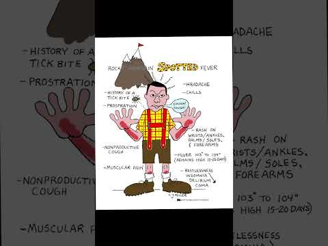 Rocky Mountain spotted fever #nclexreview #nclex #nursingexam