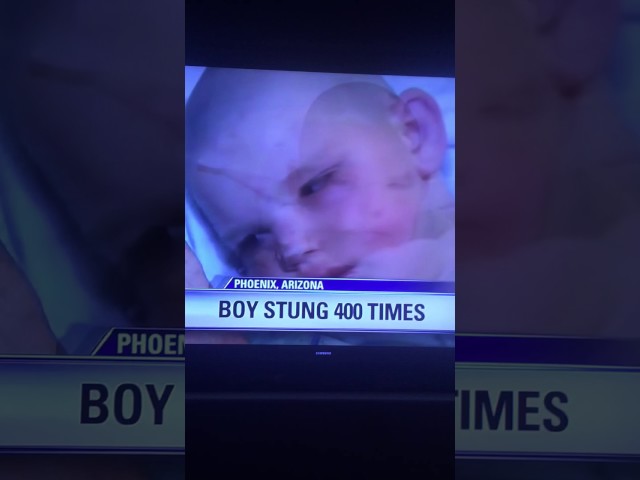 How Dragon Ball helped a kid survive after 400 bee stings