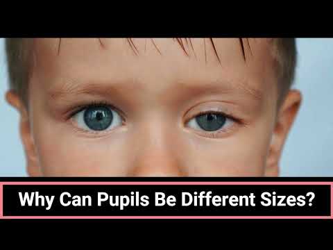 Why Can Pupils Be Different Sizes