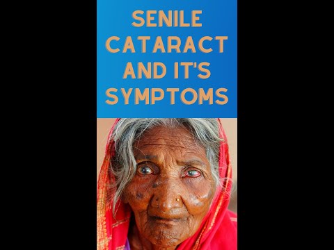 Senile Cataract in Hindi | सेनाइल मोतियाबिंद क्या है? | Senile Cataract Signs and Symptoms in Hindi