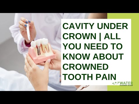 Cavity Under Crown | All You Need To Know About Crowned Tooth… – John ...