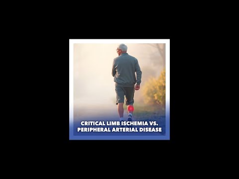 Critical Limb Ischemia Explained How to Avoid Amputation with Advanced Care #shorts