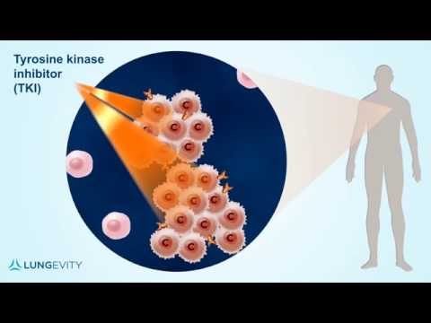 Introduction to ALK inhibitors