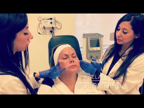 Bellafill at Schweiger Dermatology Group NYC