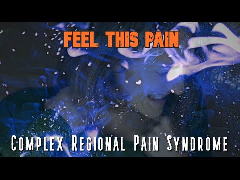 Complex Regional Pain Syndrome: Feel This Pain S2E2