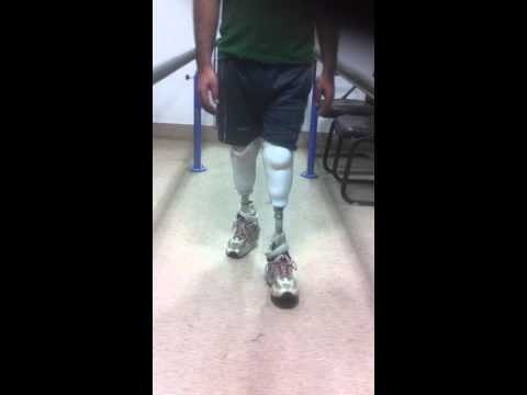 Artificial Leg Limb - Artificial Limbs Latest Price, Manufacturers ...