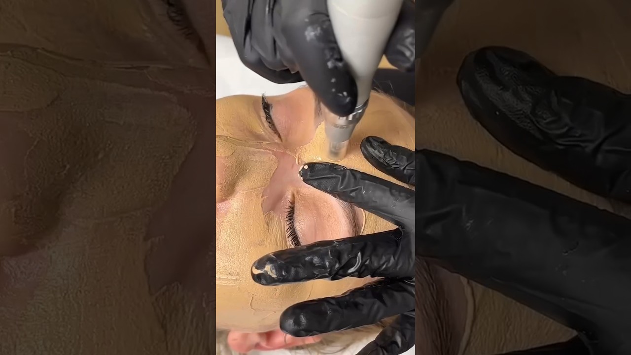 BB Perfect Skin treatment that makes you forget about foundation and concealer for a whole year! ⏳