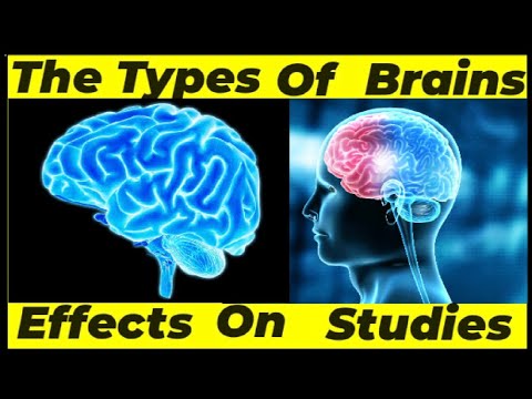 What Type Of Brain Do You Have?