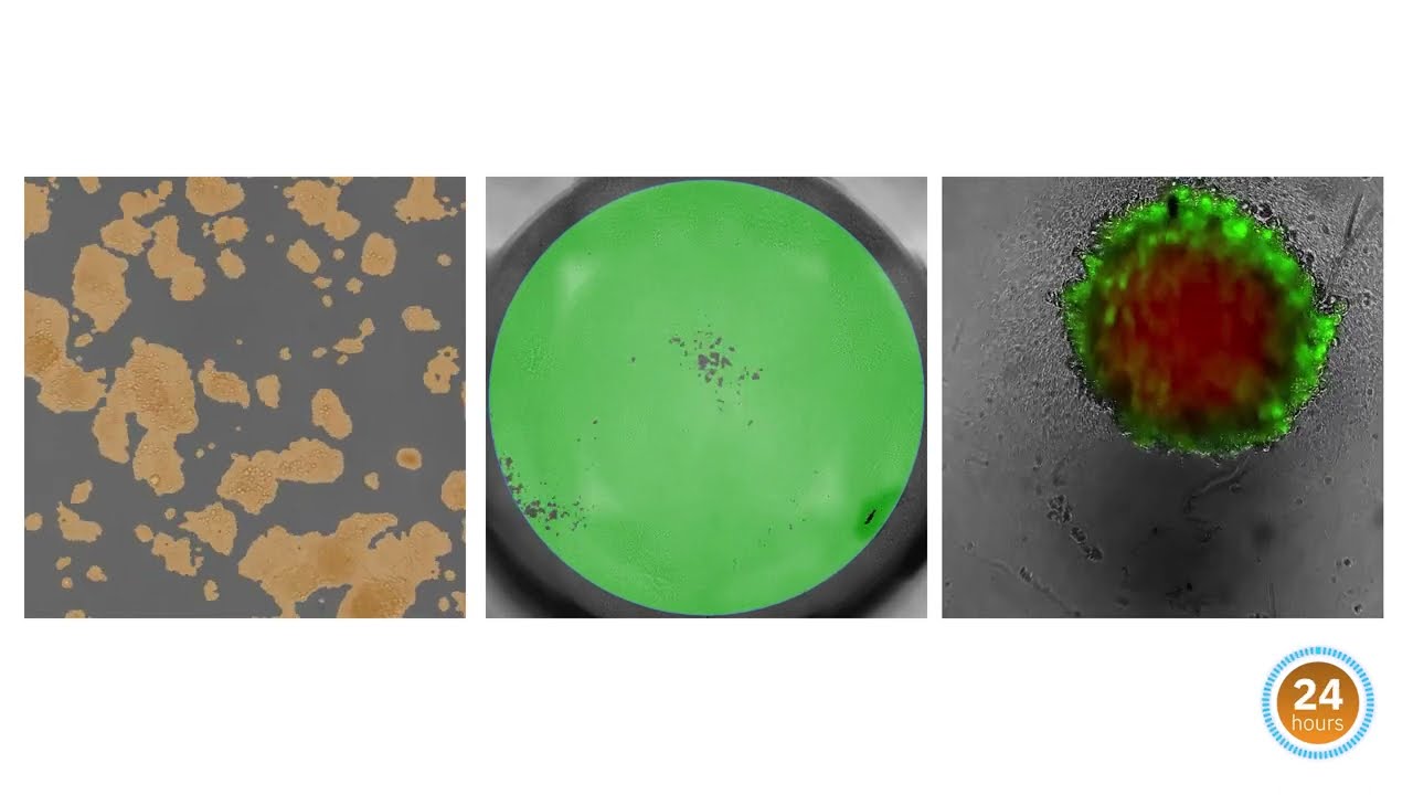 Track biology in real-time with Axion BioSystems' Omni Live-Cell Imaging and Analysis