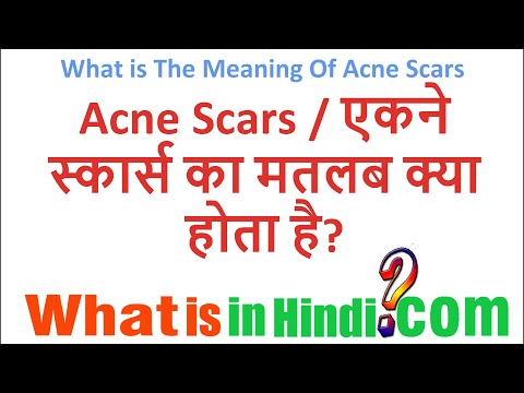 What is the Meaning of Acne Scars in Hindi | Acne Scars ka matlab kya hota hai