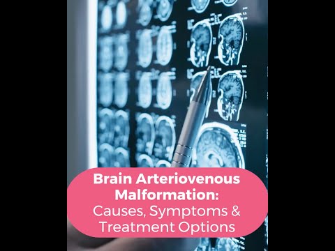 Brain Arteriovenous Malformation (AVM): Causes, Symptoms, and Treatment Options