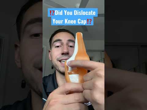 Did you dislocate your knee cap? (Find out why it keeps dislocating) #shorts