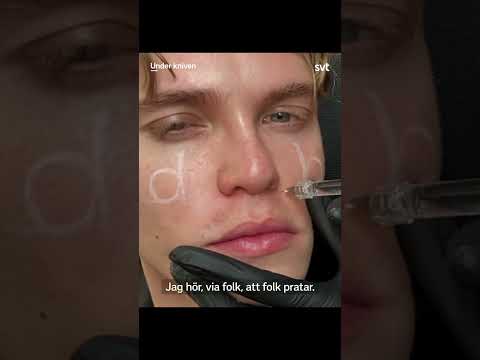 Erik Gallis hemliga skönhetsingrepp 💉 Streama dokumentärserien Under kniven på SVT Play