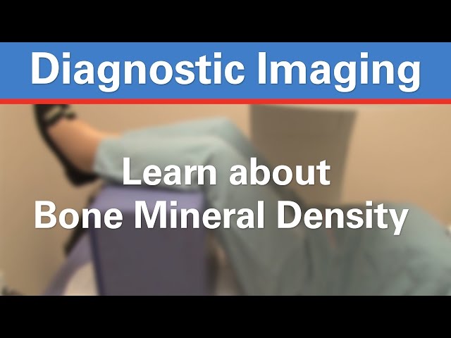 Understanding Bone Mineral Density Tests: What You Need to Know About ...