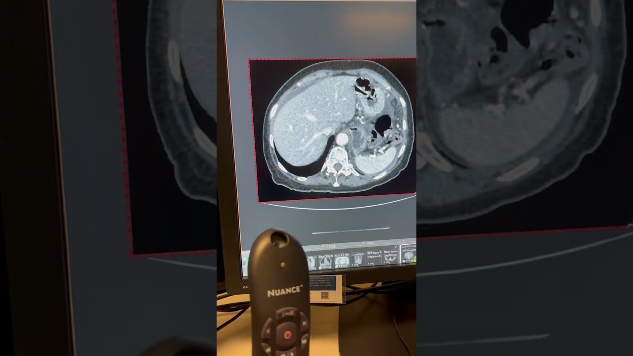 Saving medical images for educational presentations onto PowerPoint