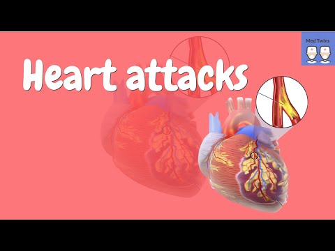 What is a heart attack? [Pathophysiology, STEMI, NSTEMI, ECG interpretation, Diagnosis, Symptoms]