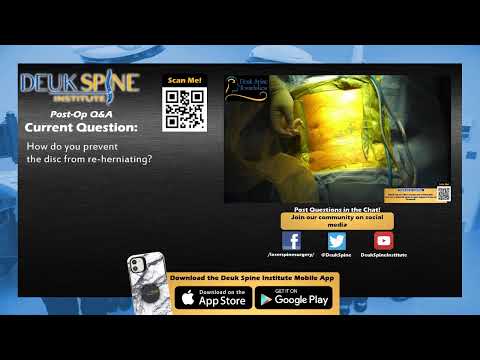 Endoscopic Laser Disc Repair L4-5: Minimally-Invasive Surgery BETTER Than Fusion