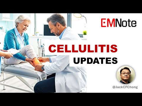 Updates in Cellulitis Management