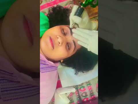 permanent eyebrow feel laser treatment