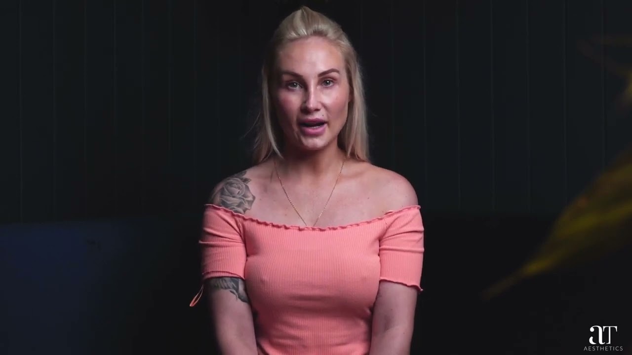 Rhinoplasty Patient Testimonial | Dr Adnan Tahir - Plastic Surgeon in Dubai