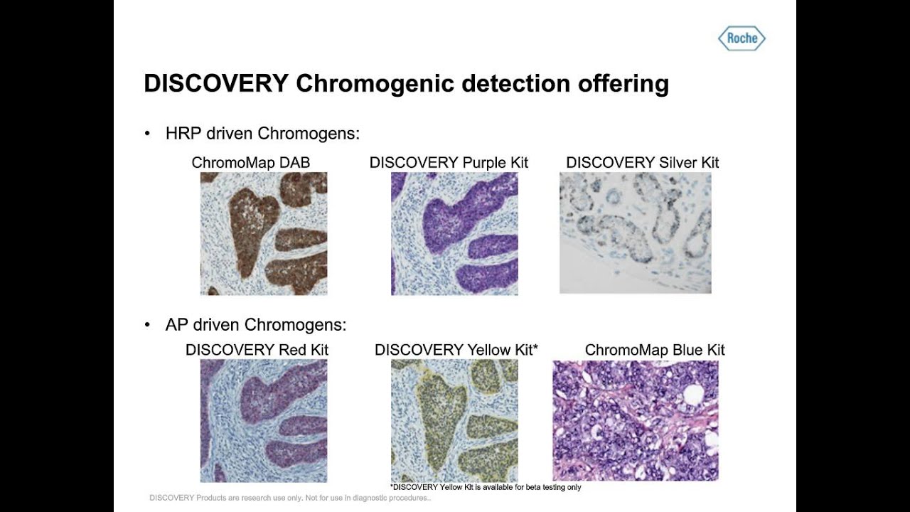 Multiplexed IHC/ISH Using an Automated Slide Staining Platform