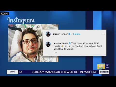 Jeremy Renner shares update on snowplow accident, 'Barbie' movie cast revealed