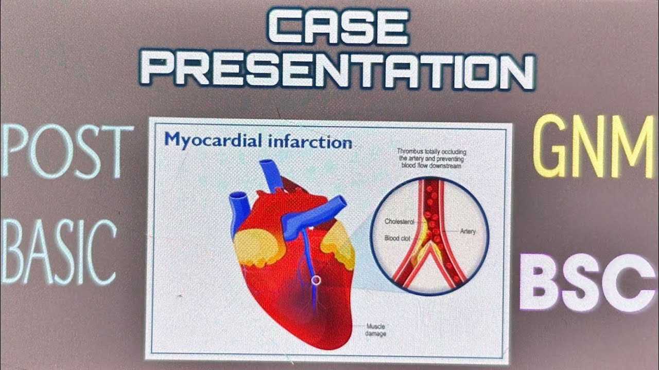 case presentation/ case study, anatomy and physiology, medical surgical nursing.