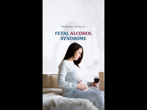 Fetal alcohol syndrome -By Dr. Arvind Otta #psychology #syndrome #pyshcologysyndrome #learn #fun