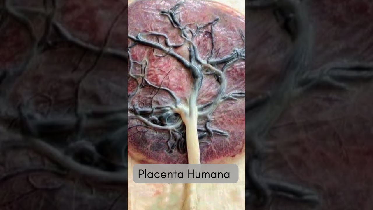 A semelhança entre a arvore da vida, a placenta humana e o córtex cerebral.