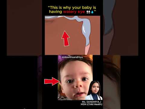 👶💧 Baby Watery Eyes?/ Simple massage