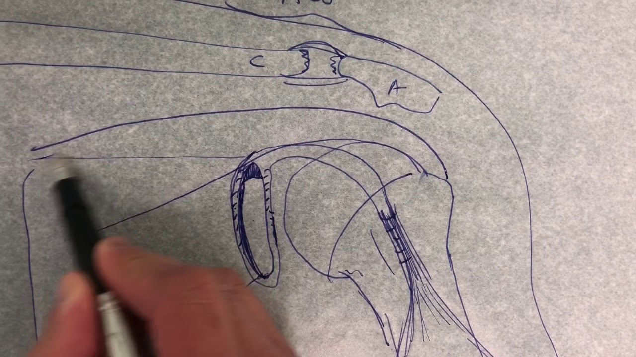How to draw a shoulder -Dr Mora